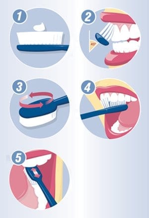 Correct Tooth Brushing Technique - Warners Bay Dental